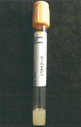 N: TUBE VACUTAINER DRAW 5ML SST BRAND GOLD HEMOGARD CLOSURE - 531509