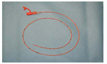 What Is A Keo Feeding Tube